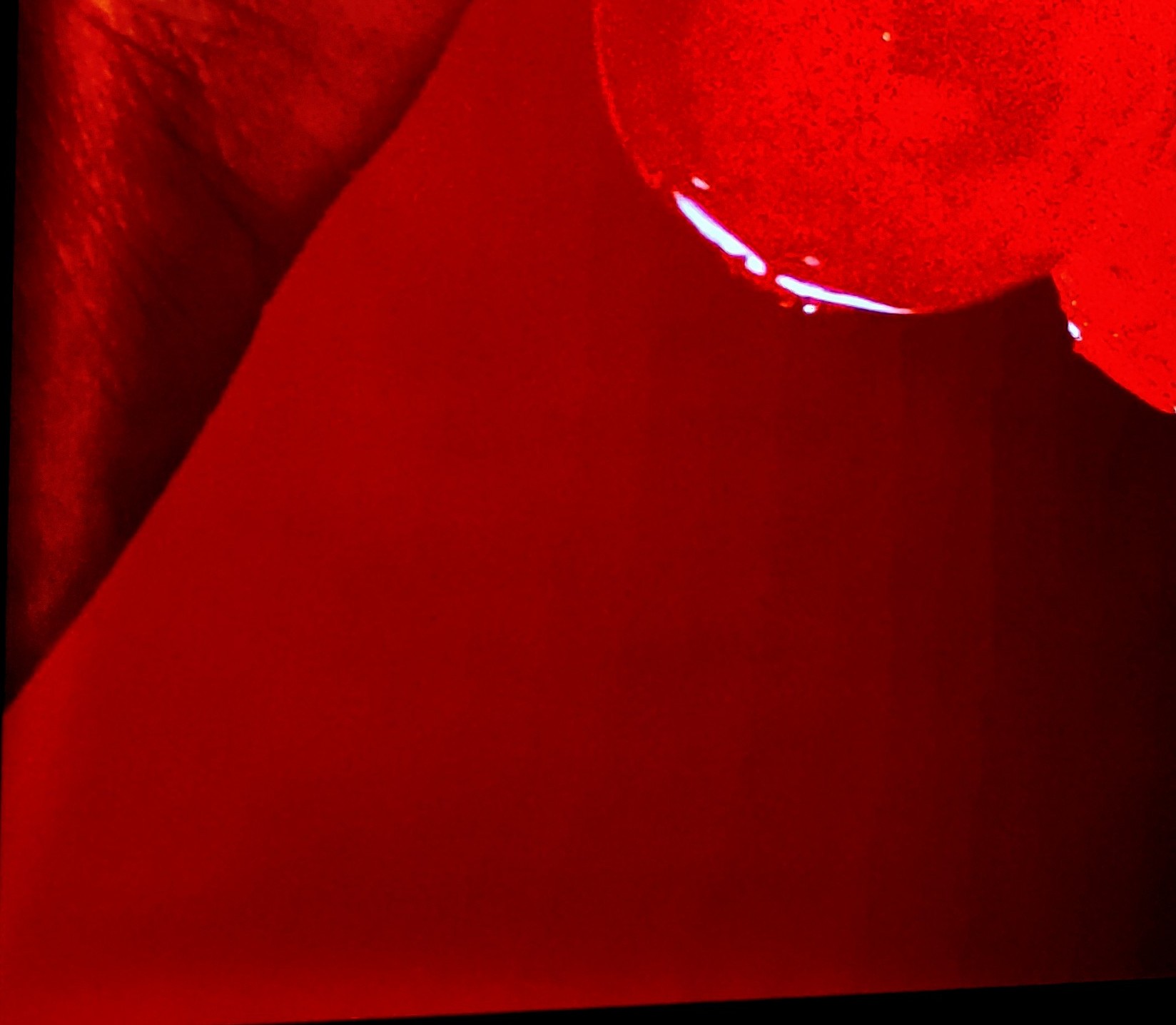 Color banding issue on Fire TV Stick 4K Max